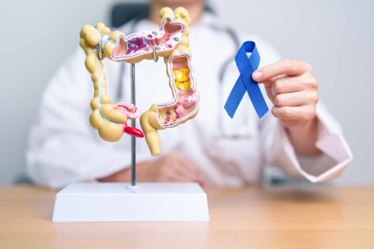 Colorectal Cancer CRISIS: Young Adults at Risk | Capital Hill News